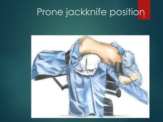 combined Spinal Epidural anaesthesia ppt | PPT