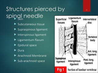 combined Spinal Epidural anaesthesia ppt | PPT