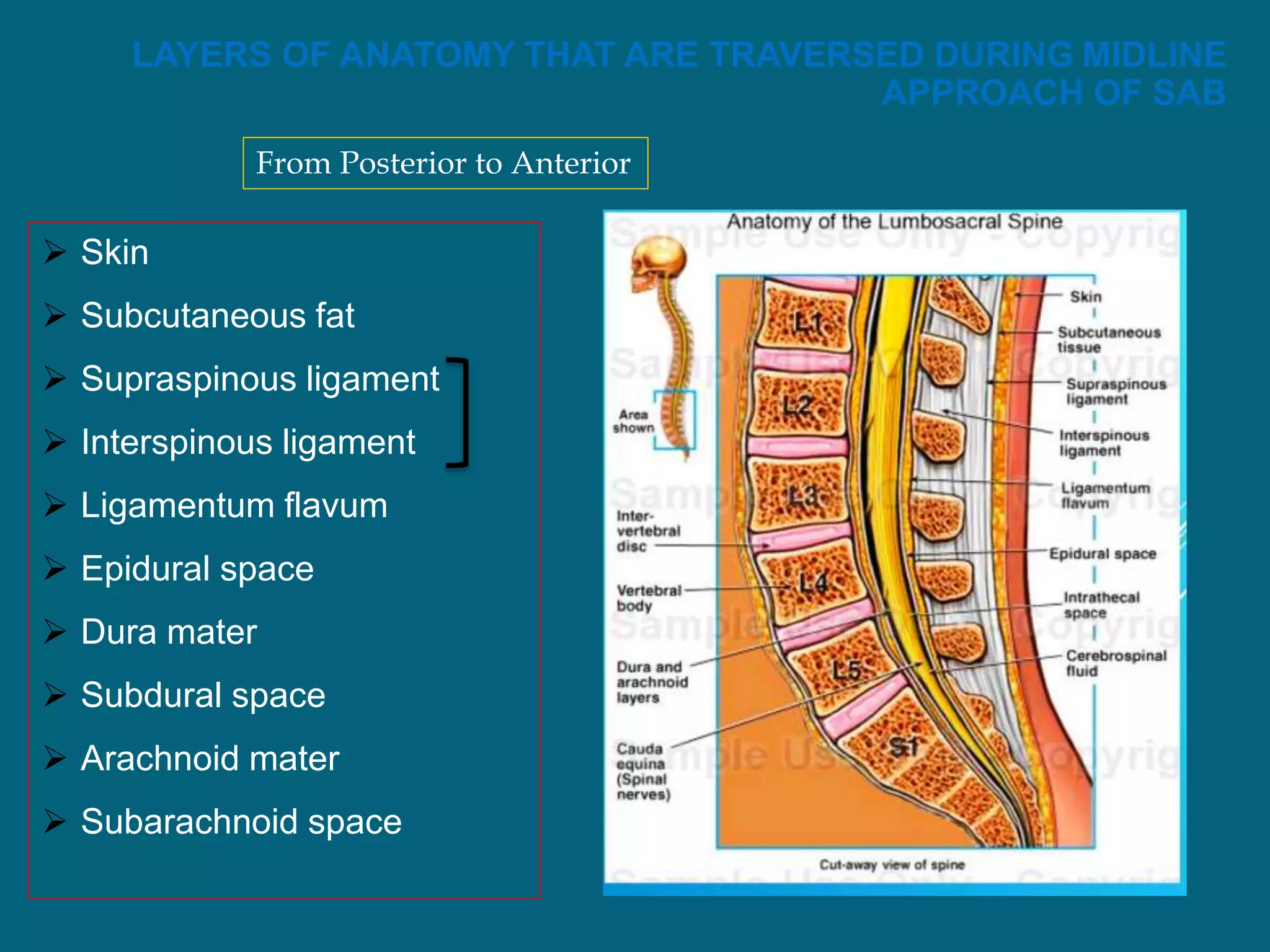 Spinal epidural | PPTX