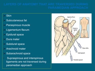 Spinal epidural | PPTX | Death, Injury, or Military Conflict ...