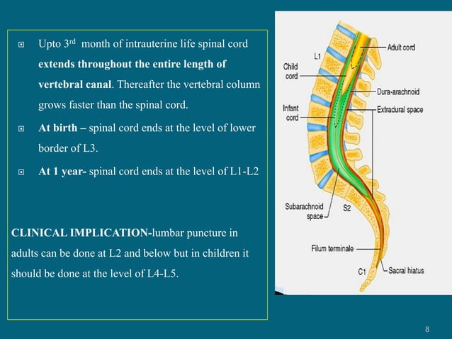 Spinal epidural | PPT