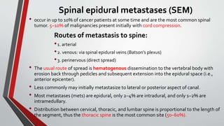 spinal epidural mets.pptx