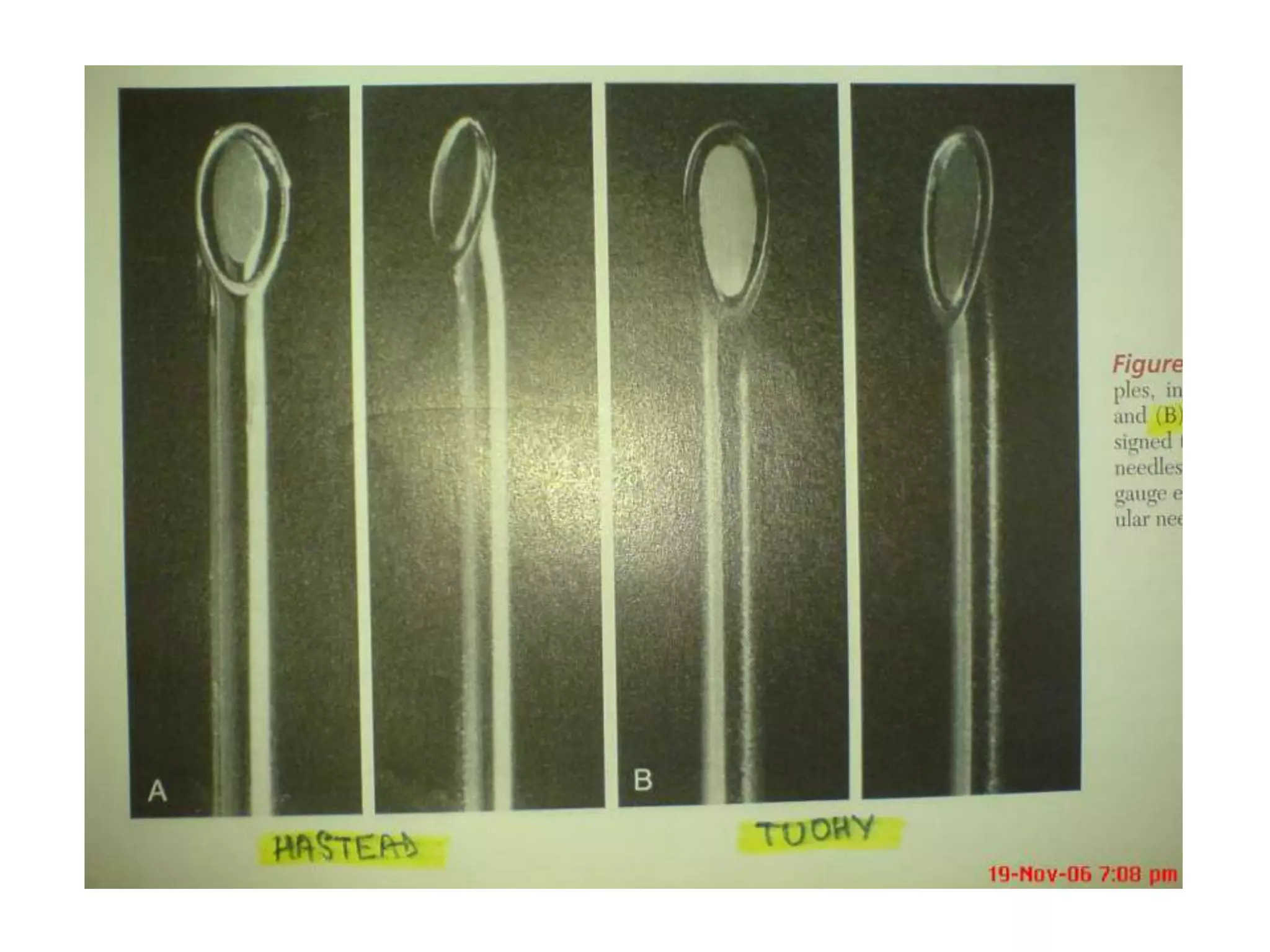 Spinal & epidural needle | PPTX