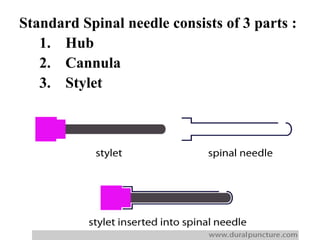 Epidural Needle Types
