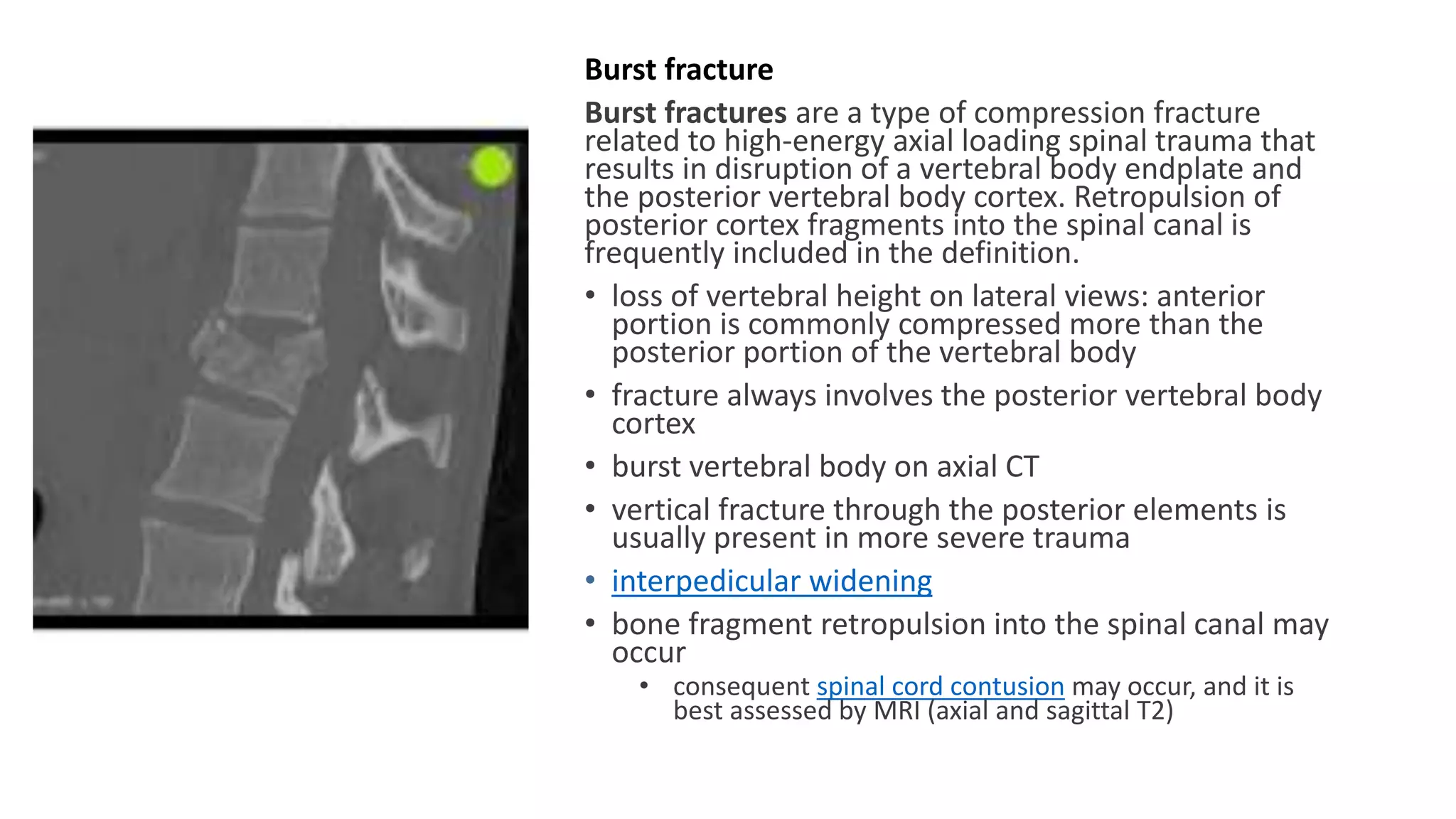 Spinal Fractures.pptx