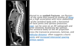 Spinal Fractures.pptx