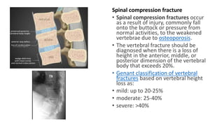 Spinal Fractures.pptx