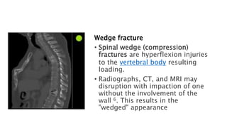 Spinal Fractures.pptx