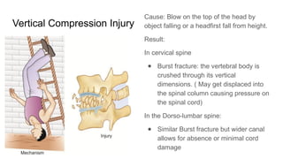 Spinal Fractures....................pptx | Death, Injury, or Military ...
