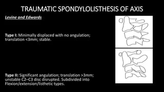 Spinal fractures classification - Core Surgical Trainees' teaching | PPTX