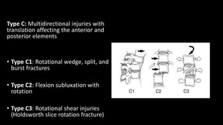 Spinal fractures classification - Core Surgical Trainees' teaching | PPTX