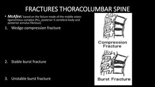 Spinal fractures classification - Core Surgical Trainees' teaching | PPTX