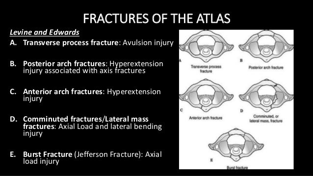 Jefferson Fracture Classification C1 Vertebral (Jefferson) Fractures