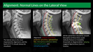 Spinal Fusion: Role of Perioperative Radiography | PPTX