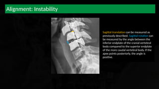 Spinal Fusion: Role of Perioperative Radiography | PPTX