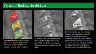 Spinal Fusion: Role of Perioperative Radiography | PPTX
