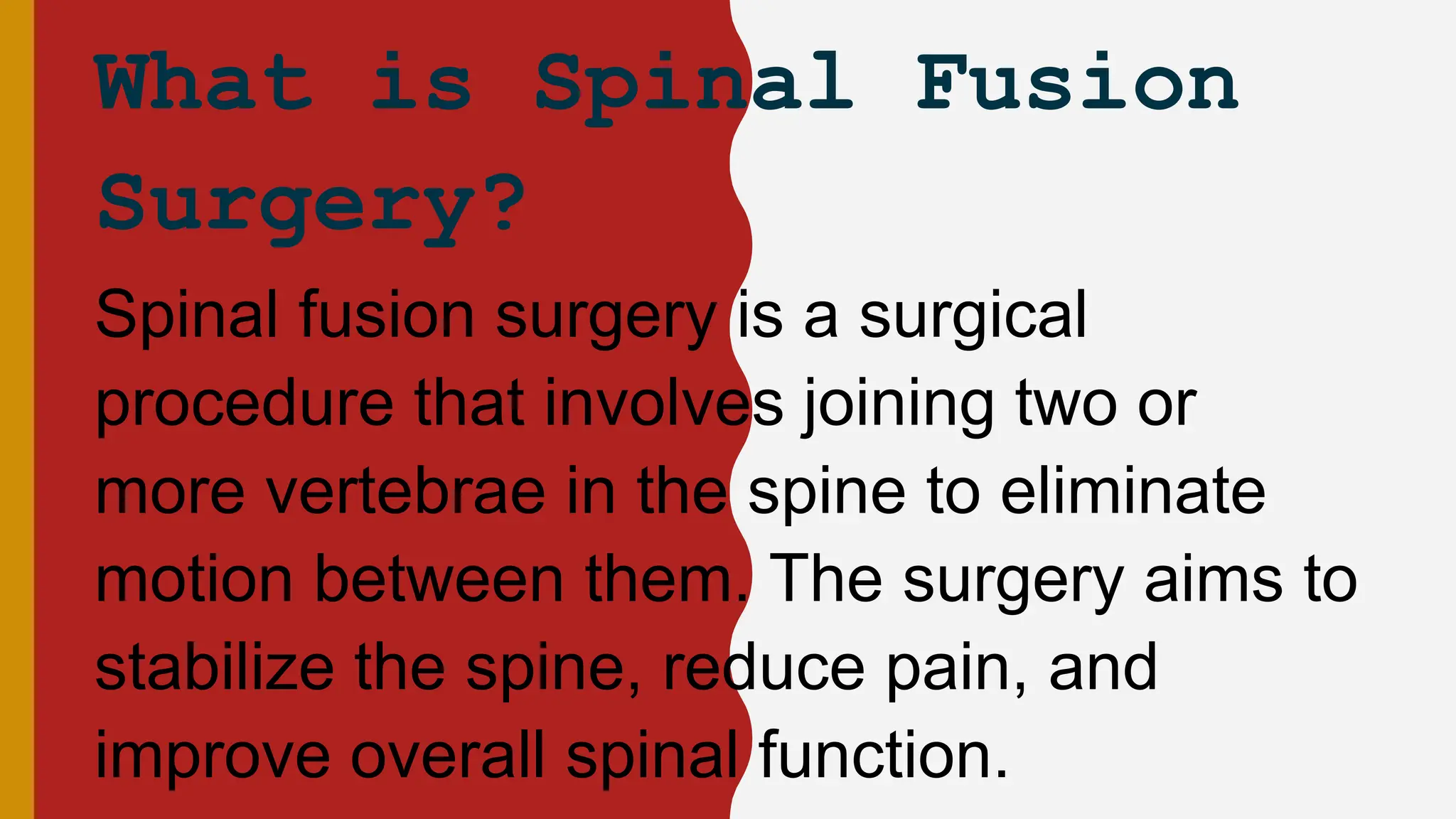 Spinal Fusion Surgery in Indore : Understanding the Procedure and ...