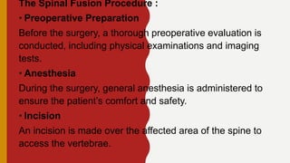 Spinal Fusion Surgery in Indore : Understanding the Procedure and ...