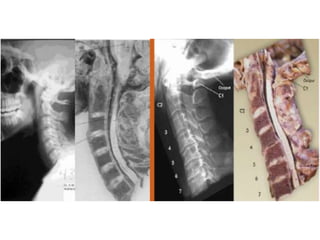 Spinal Health: A Presentation About Spinal Hygiene and How to Take Care ...