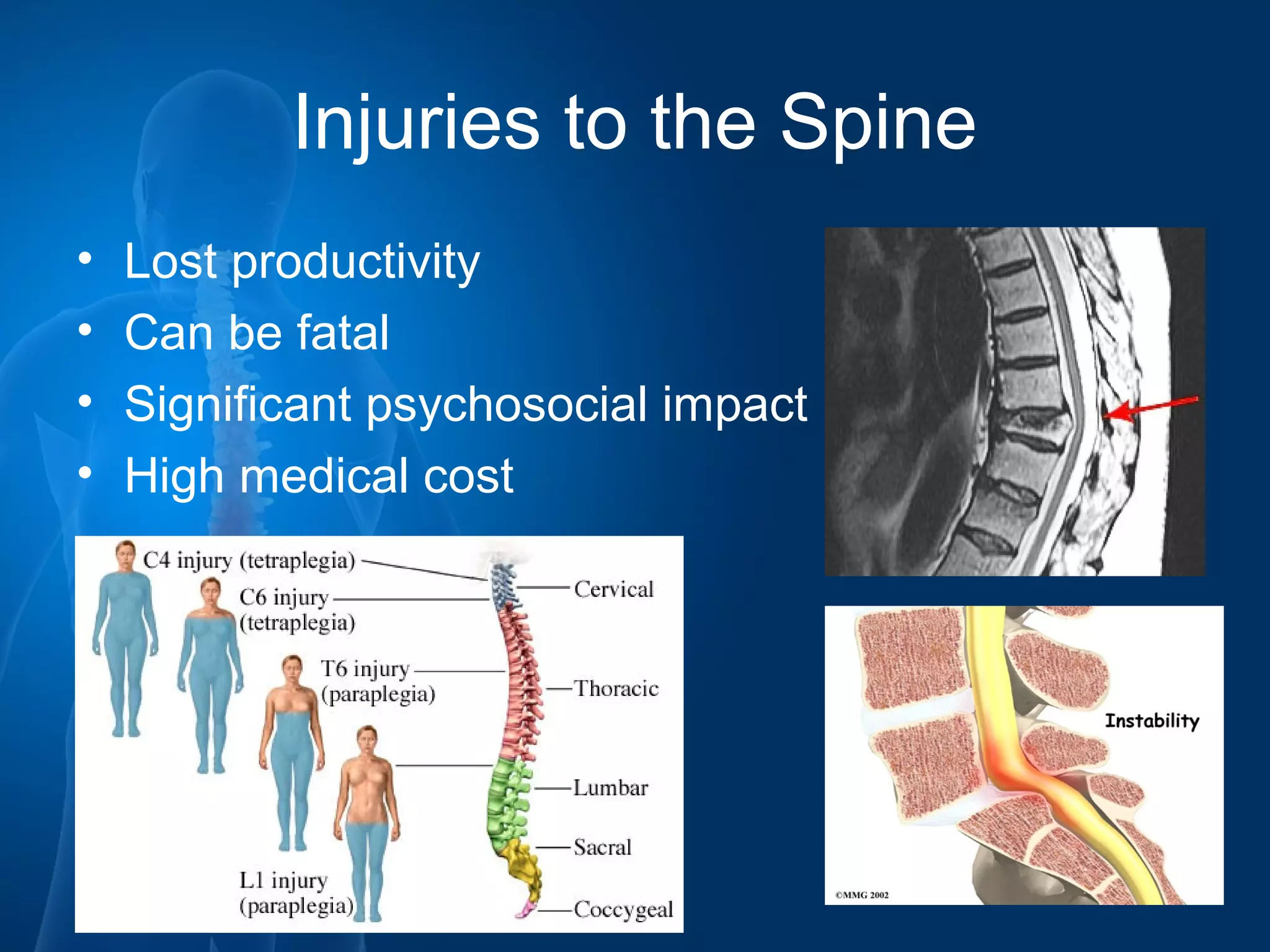 Spinal immobilization, Treatment or Torture? | PPT