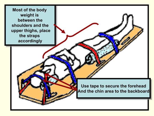Spinal immobilization.ppt 2 | PPT | First Aid | Injuries