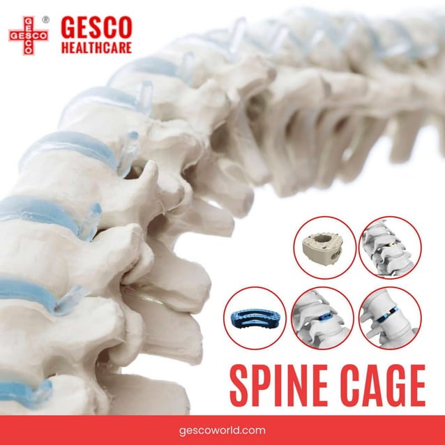 spinal implants | PPTX