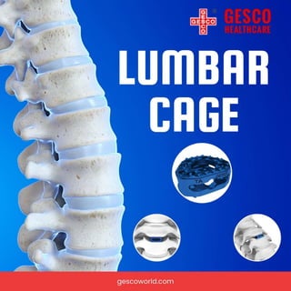 spinal implants | PPTX