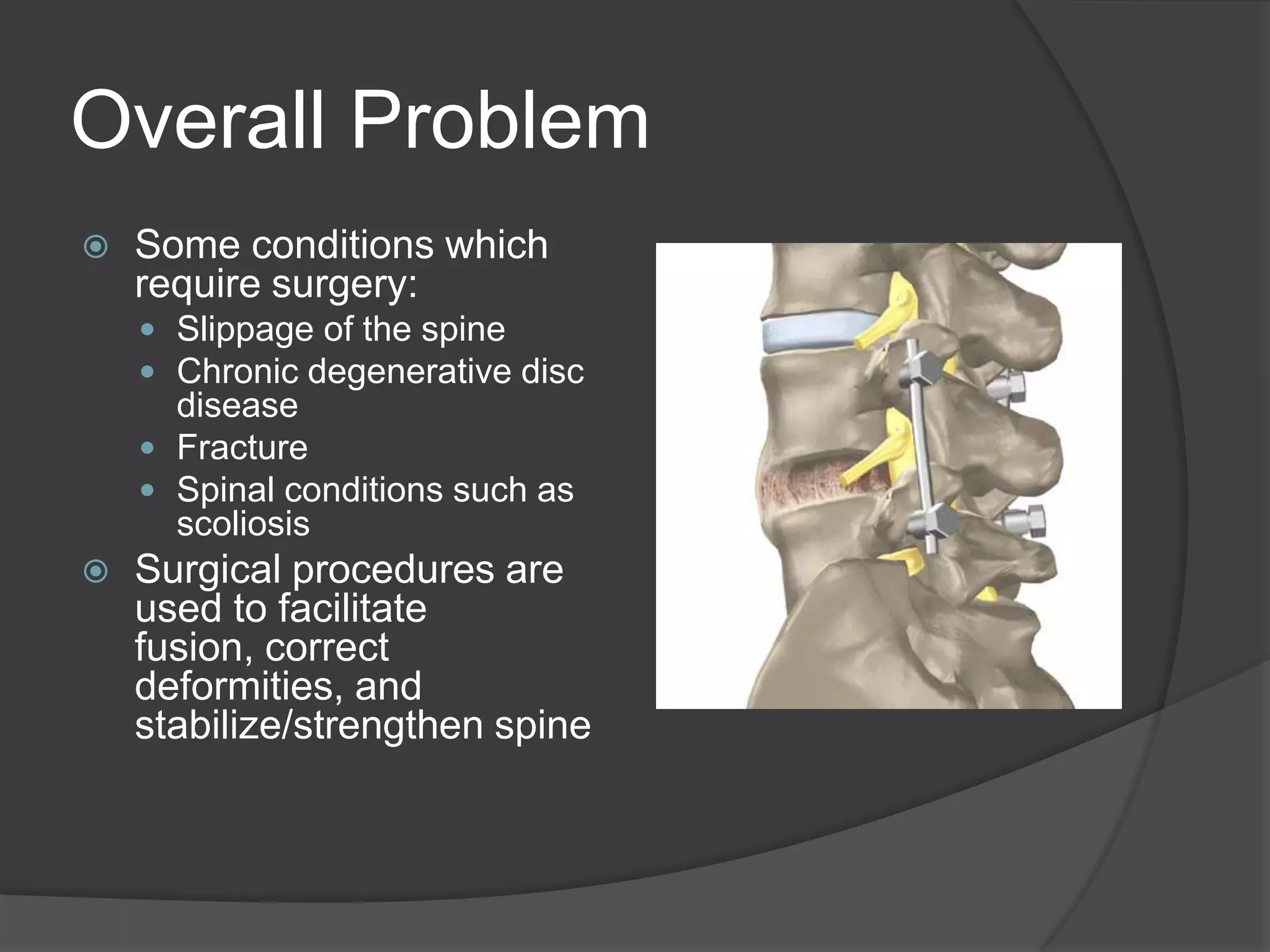 Spinal implants composed of biodegradable metals | PPTX