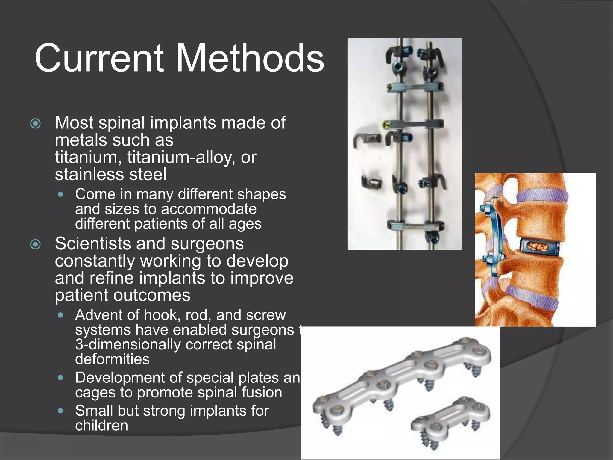 Spinal implants composed of biodegradable metals | PPTX