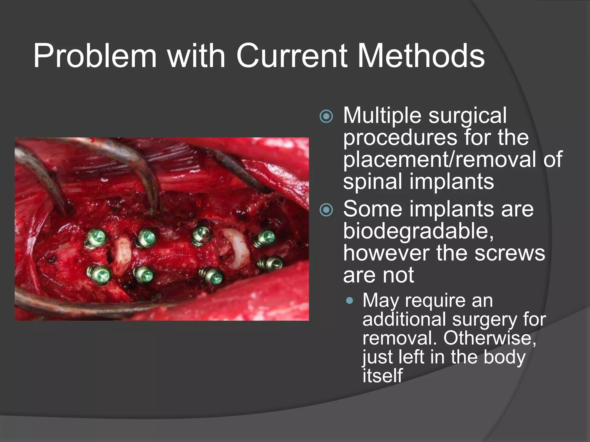 Spinal implants composed of biodegradable metals | PPT