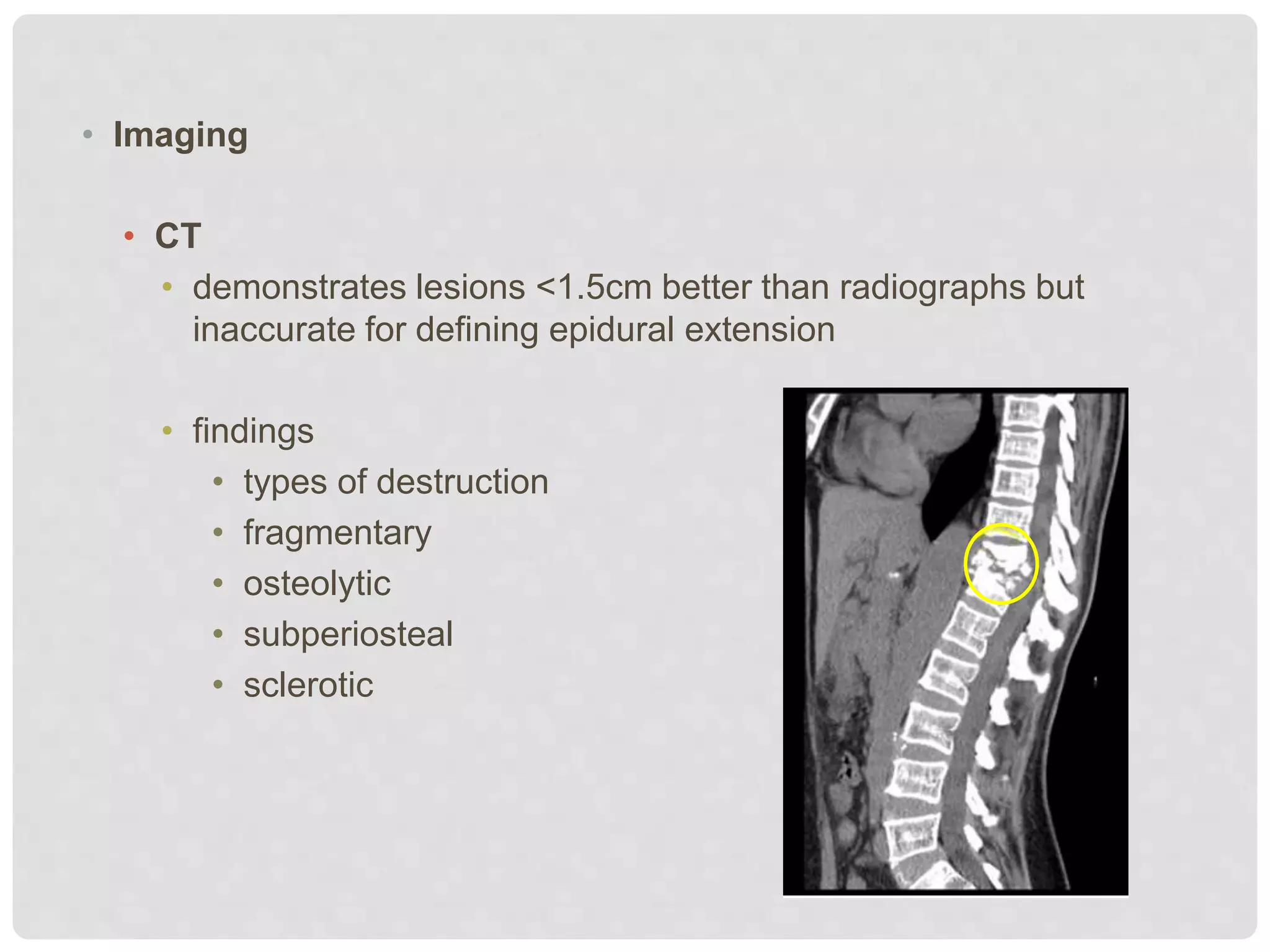 Spinal infection | PPTX