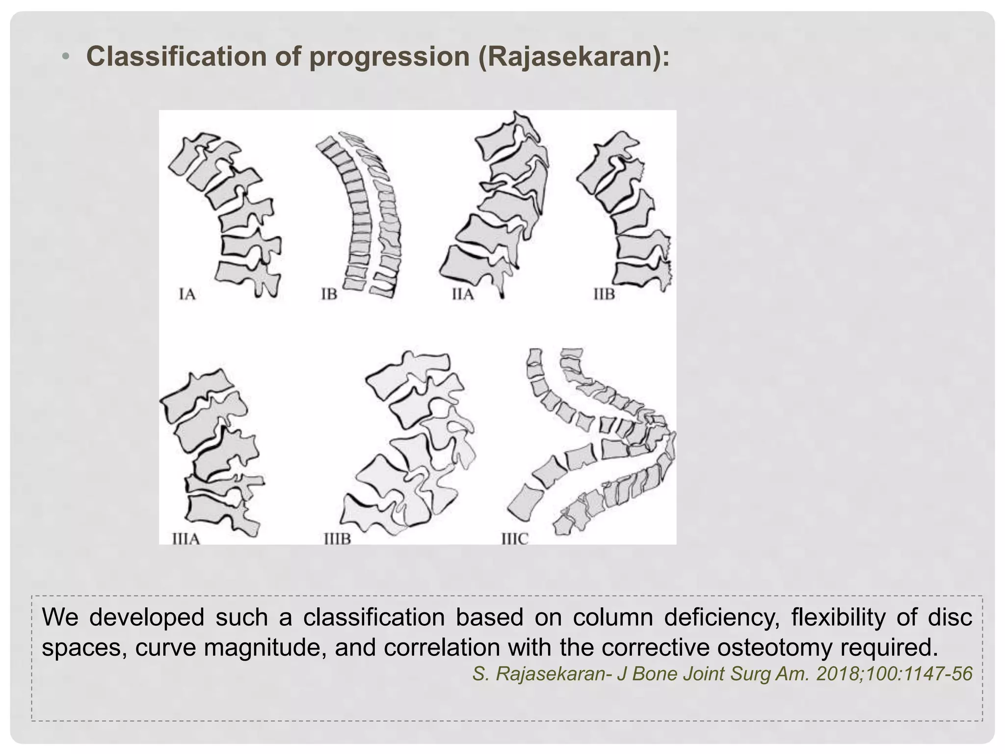 Spinal infection | PPTX