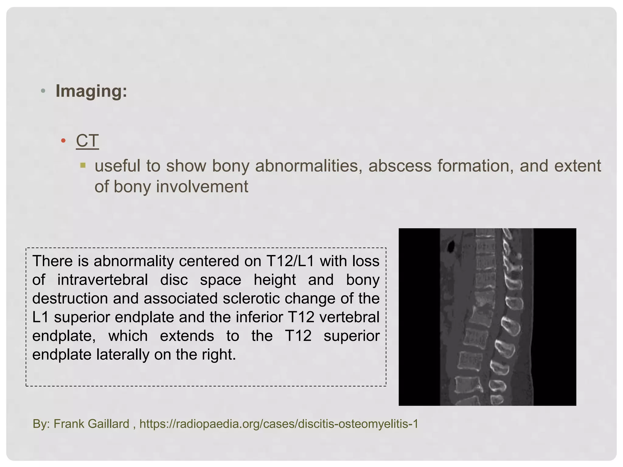 Spinal infection | PPTX