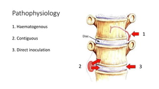 Spinal infections | PPTX
