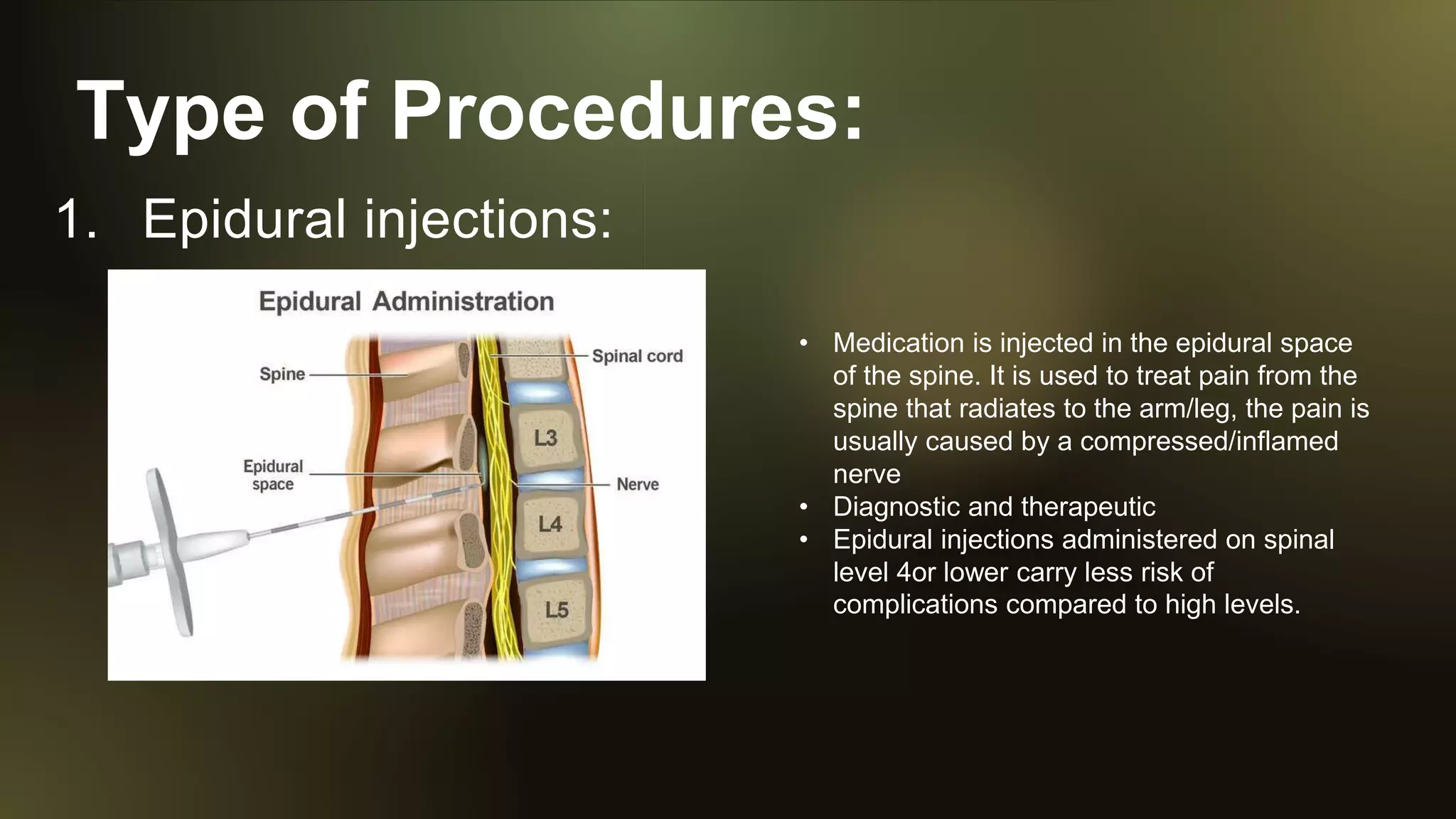 spinal injections.pptx