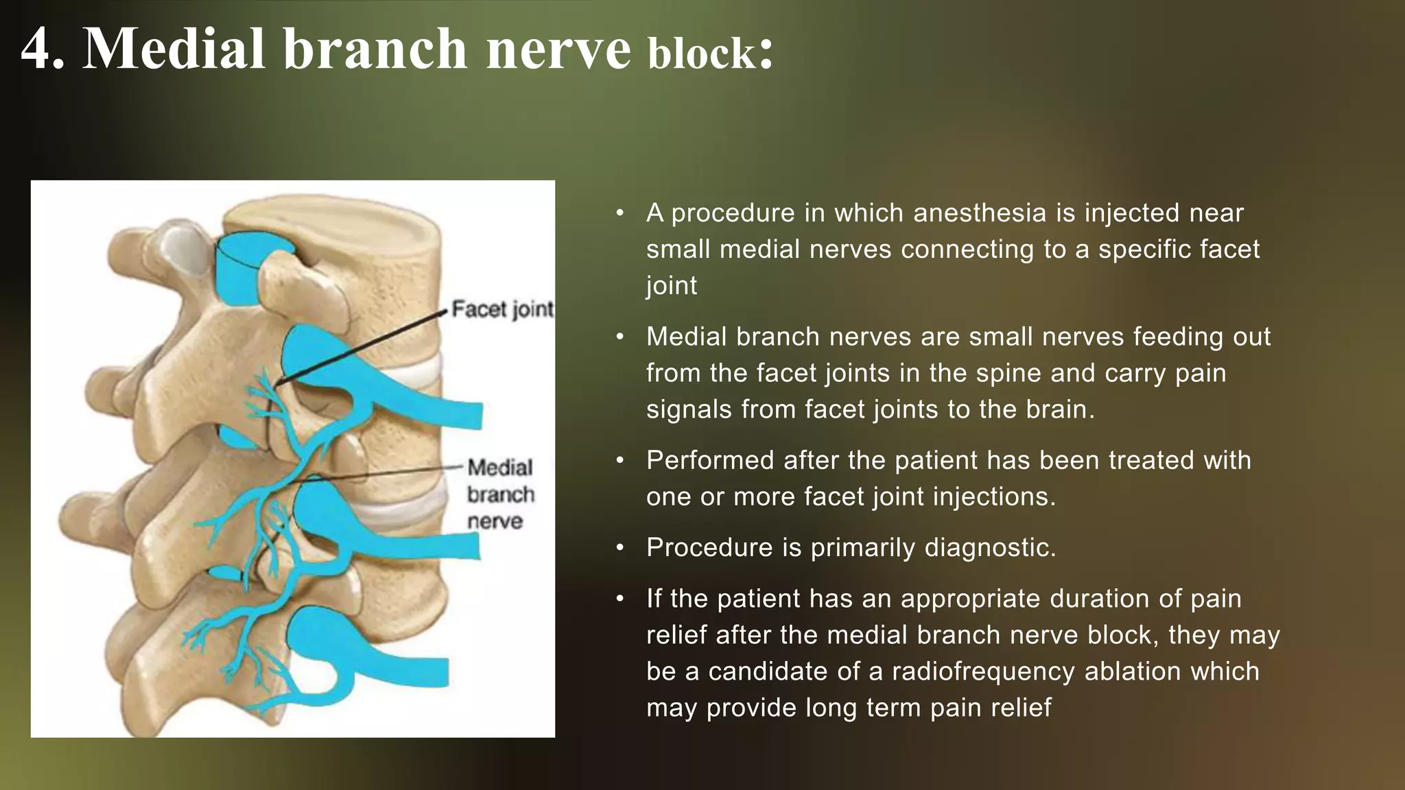 spinal injections.pptx