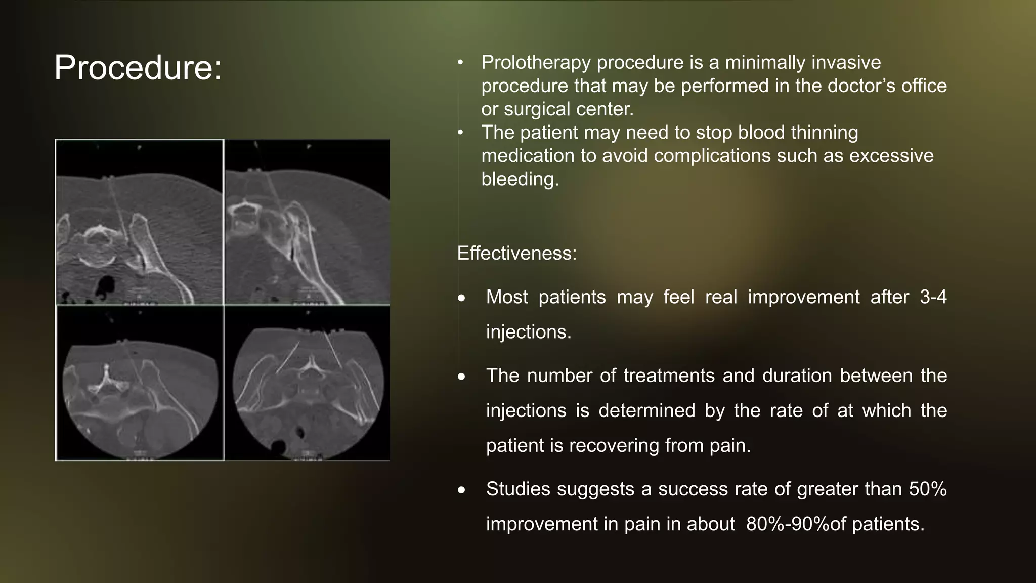spinal injections.pptx