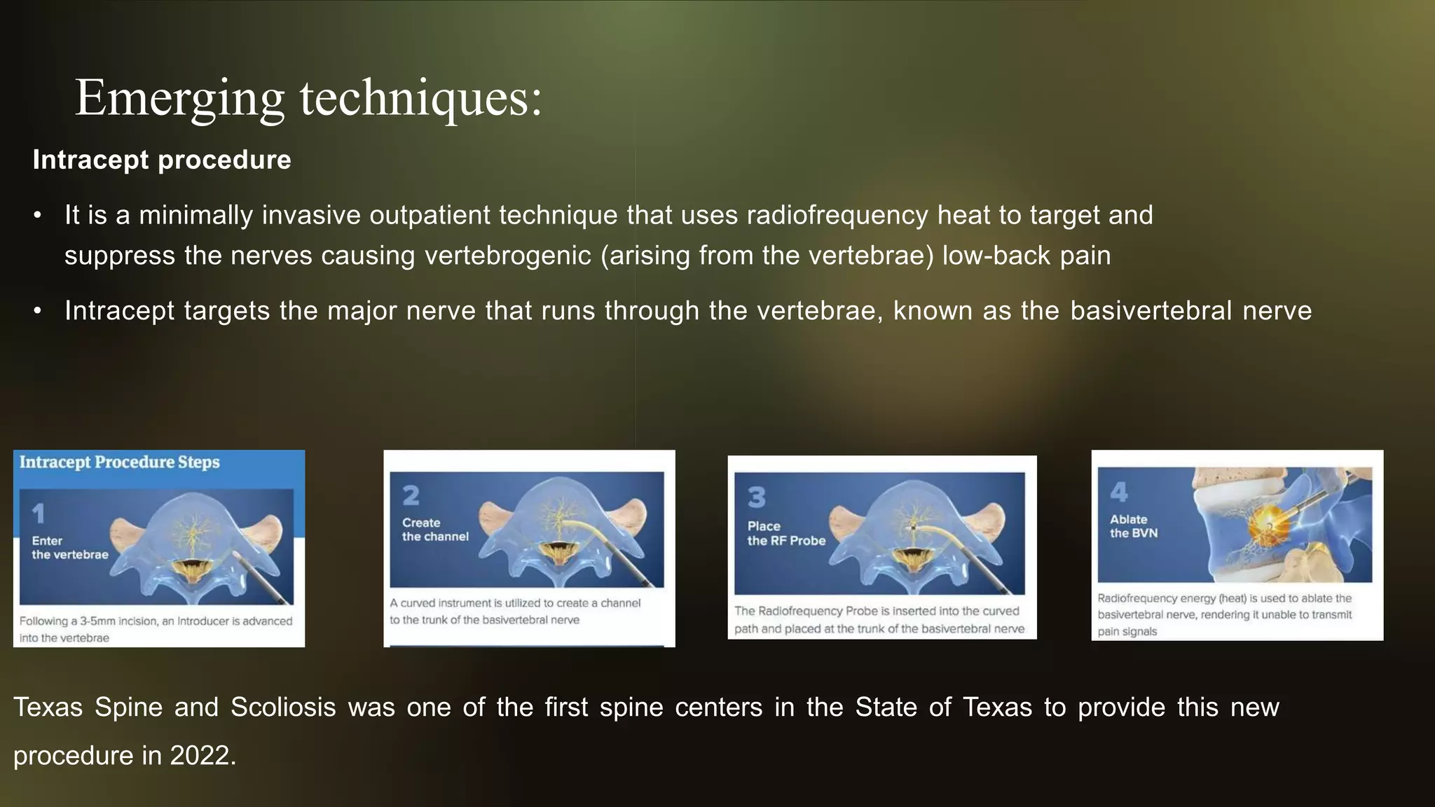 spinal injections.pptx