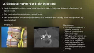spinal injections.pptx