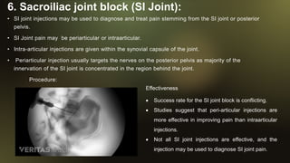 spinal injections.pptx