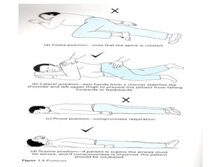 Spinal Injuries-a guide into the key concepts of spinal injuries | PPTX