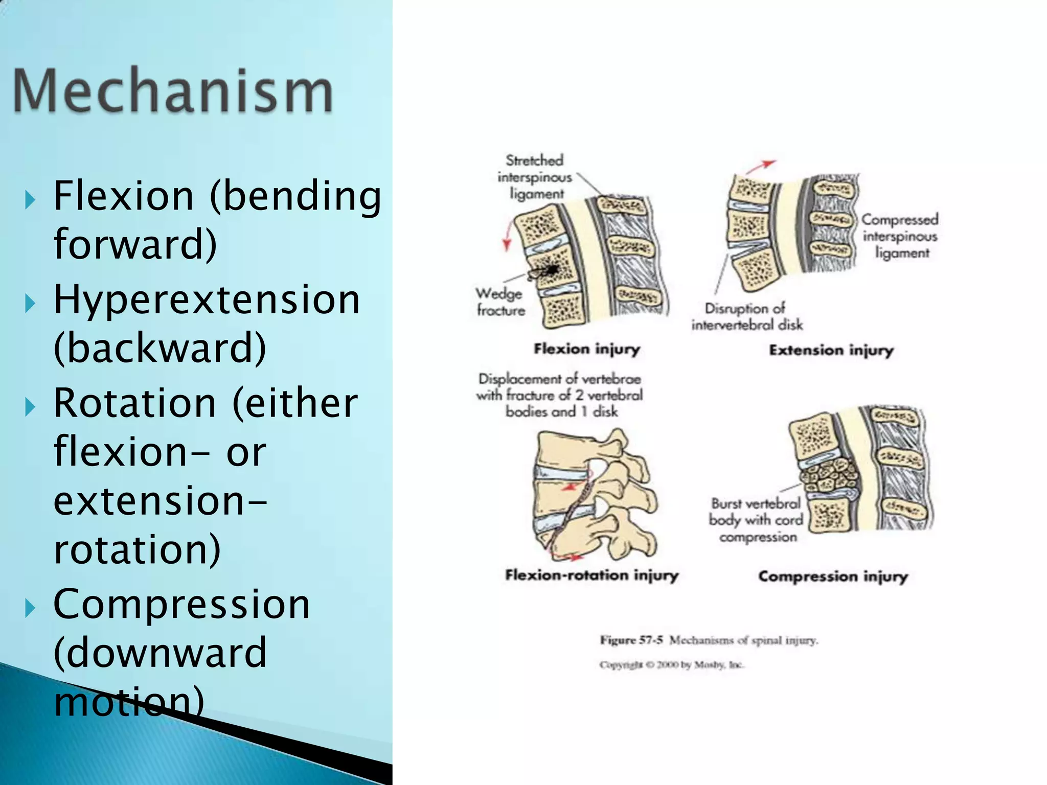 Spinal injuries | PPTX