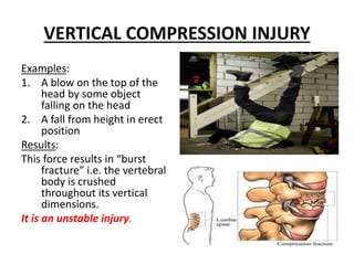 Spinal injuries | PPTX