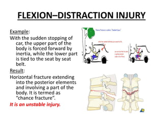 Spinal injuries | PPTX