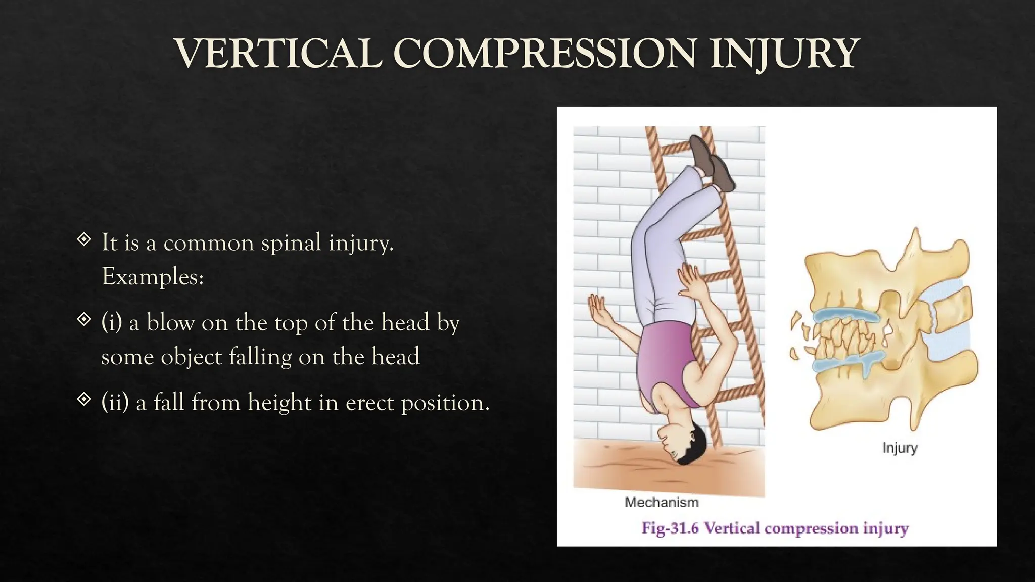 SPINAL INJURIES. Thoracolumbar and Cervical | PPTX