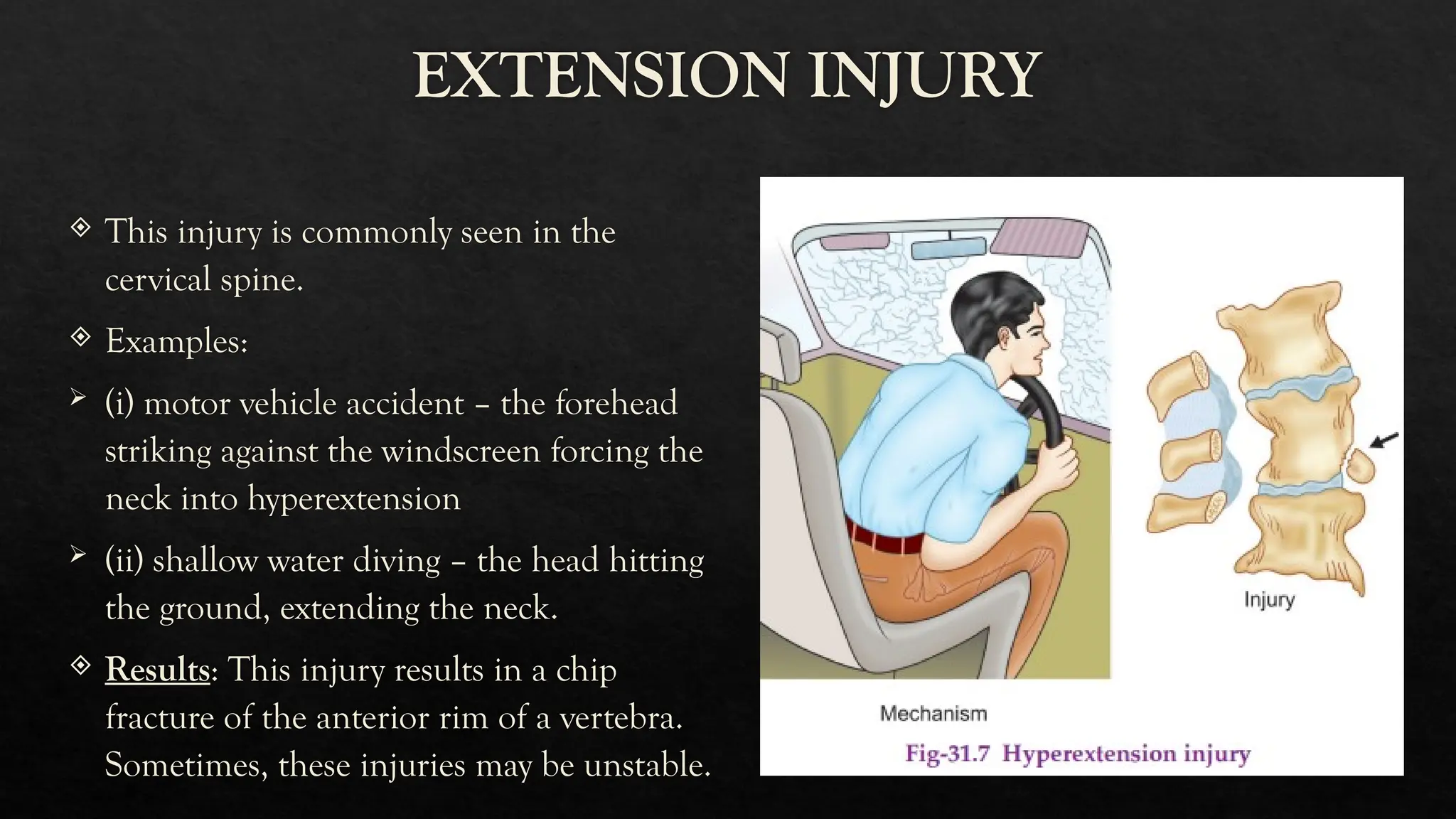 SPINAL INJURIES. Thoracolumbar and Cervical | PPTX
