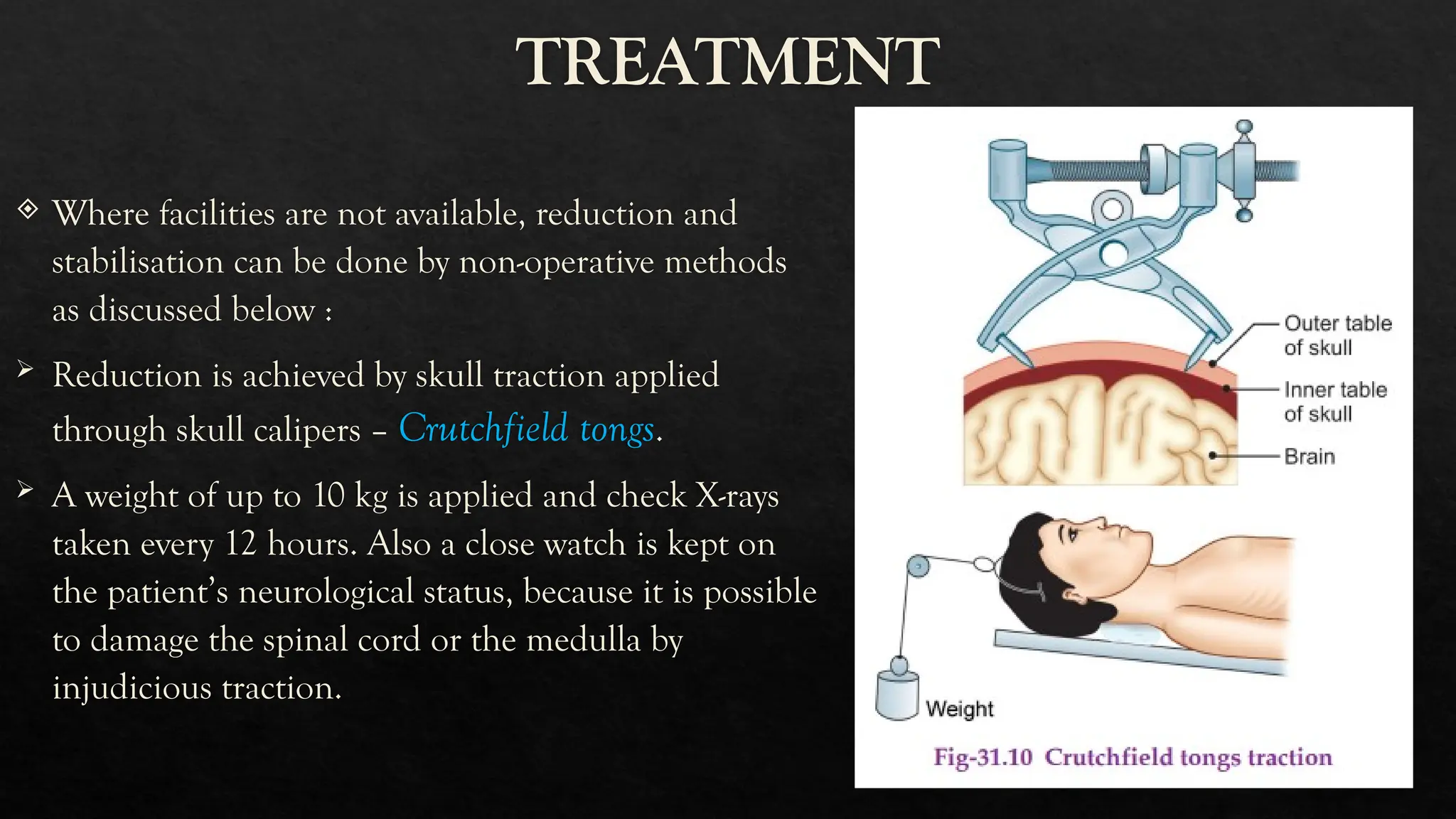 SPINAL INJURIES. Thoracolumbar and Cervical | PPTX