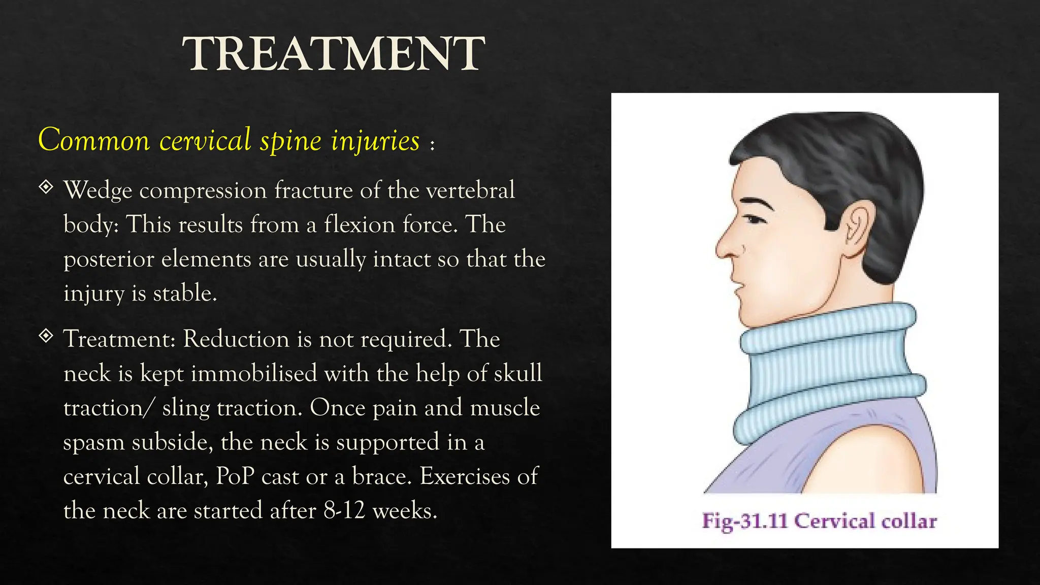 SPINAL INJURIES. Thoracolumbar and Cervical | PPTX