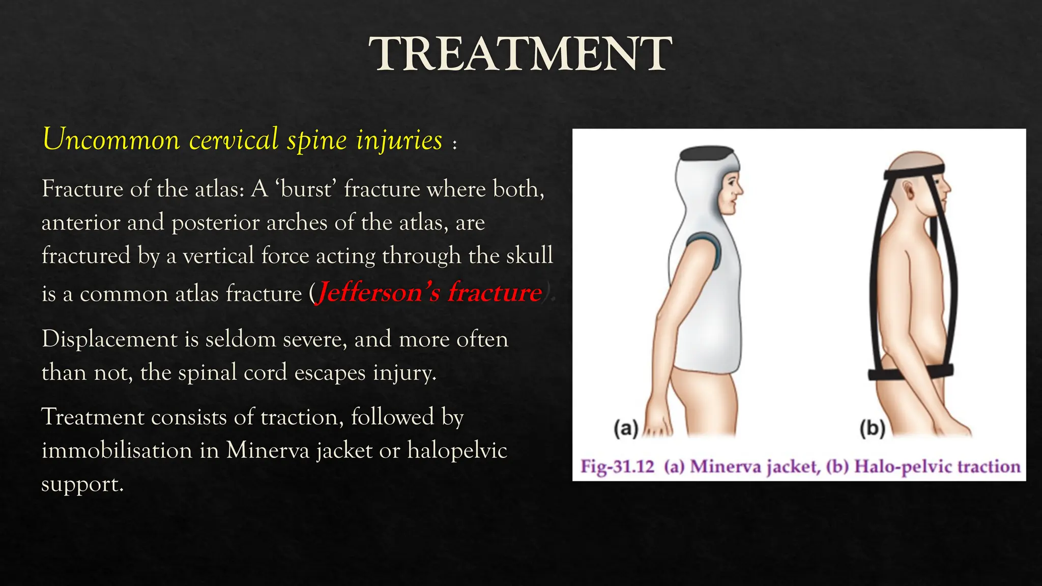 SPINAL INJURIES. Thoracolumbar and Cervical | PPTX