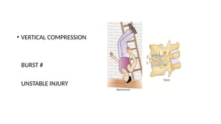 SPINAL INJURIES Anatomy three column concept log rolling investigation ...